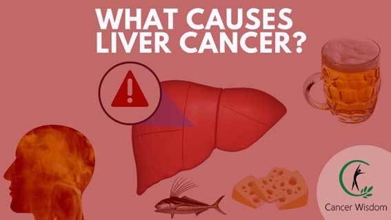 Liver Cancer Causes And How To Fix Them - Cancer Wisdom