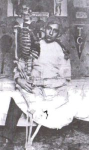 The History Of The Hoxsey Formula And How To Use It - Cancer Wisdom